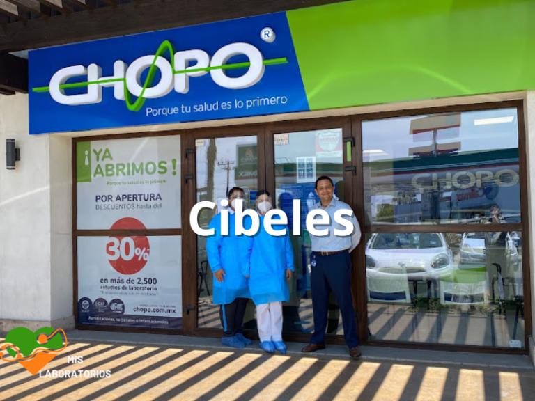 lllᐅ Chopo Cibeles Teléfono ☎️ Horarios⏰【Cita】